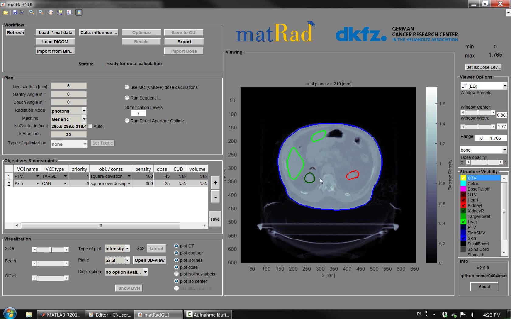 AAPM_matRad_screenGrab_take3 · CDS Videos · CERN